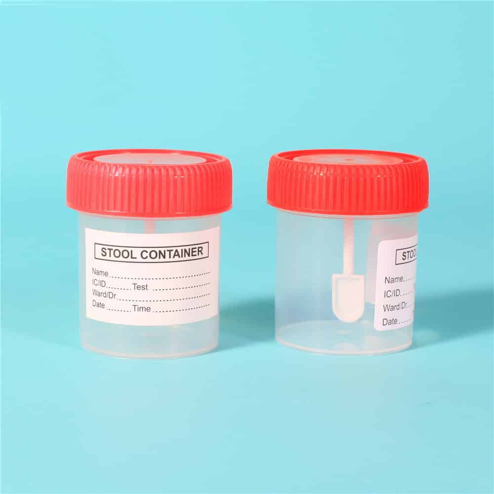 How to Give a Stool Sample with Only 4-6 Emotional Breakdowns in 50 ...